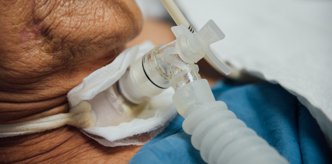 Invasive and Non-Invasive Ventilation | Erie, PA | Meadville, PA